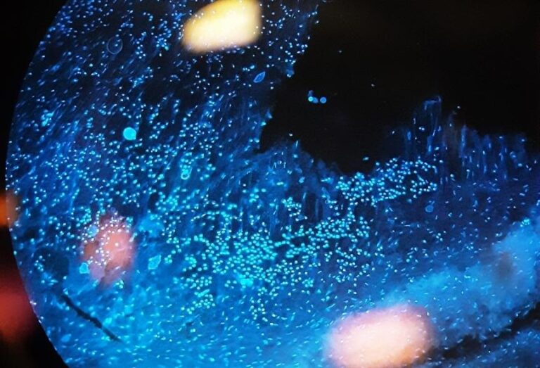 Why do turtle eggs fail to hatch? Glowing microscopic cells reveal the ...